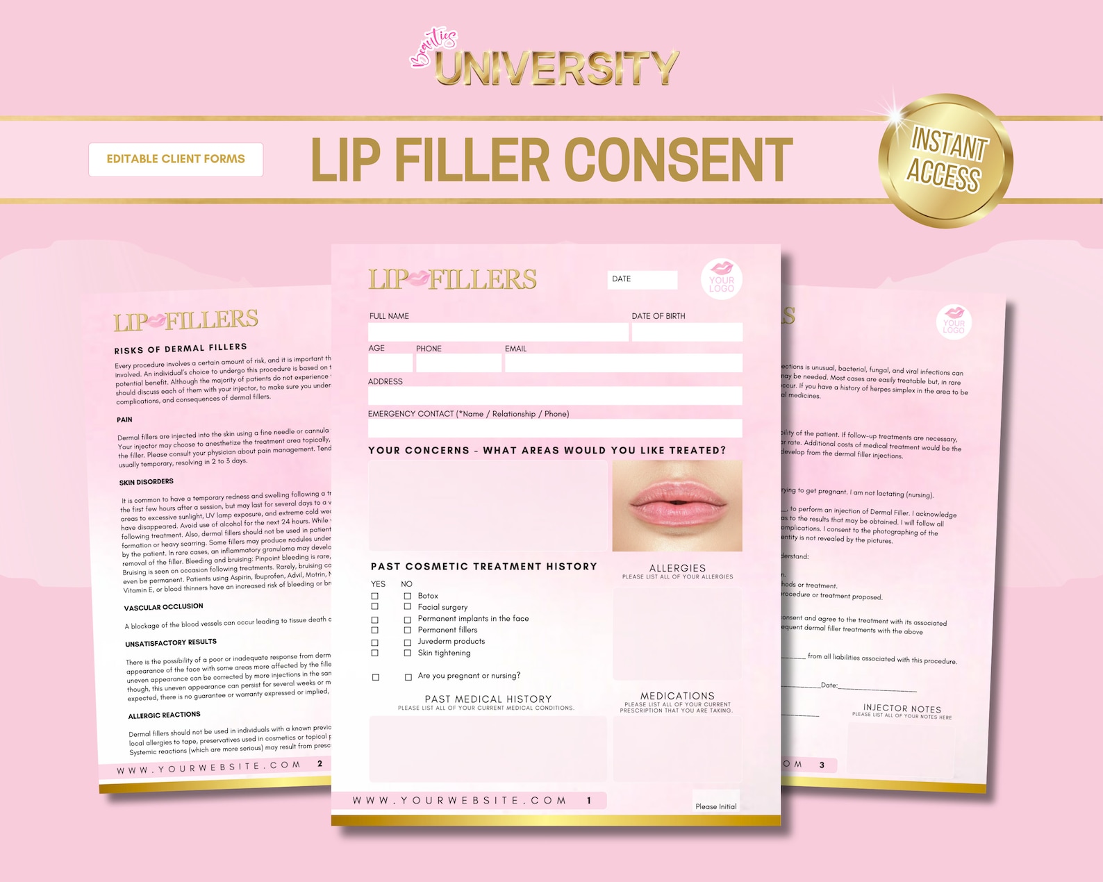 Lip Fillers Consent Forms, Lip Injections Consultation, Lip Filler ...