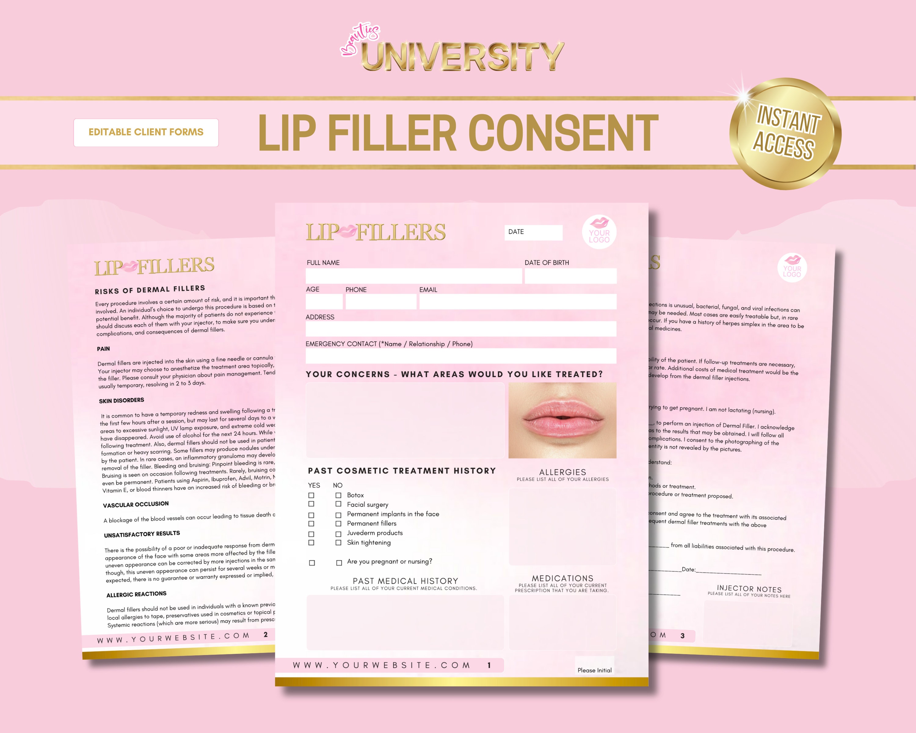 Lip Fillers Consent Forms, Lip Injections Consultation, Lip Filler ...