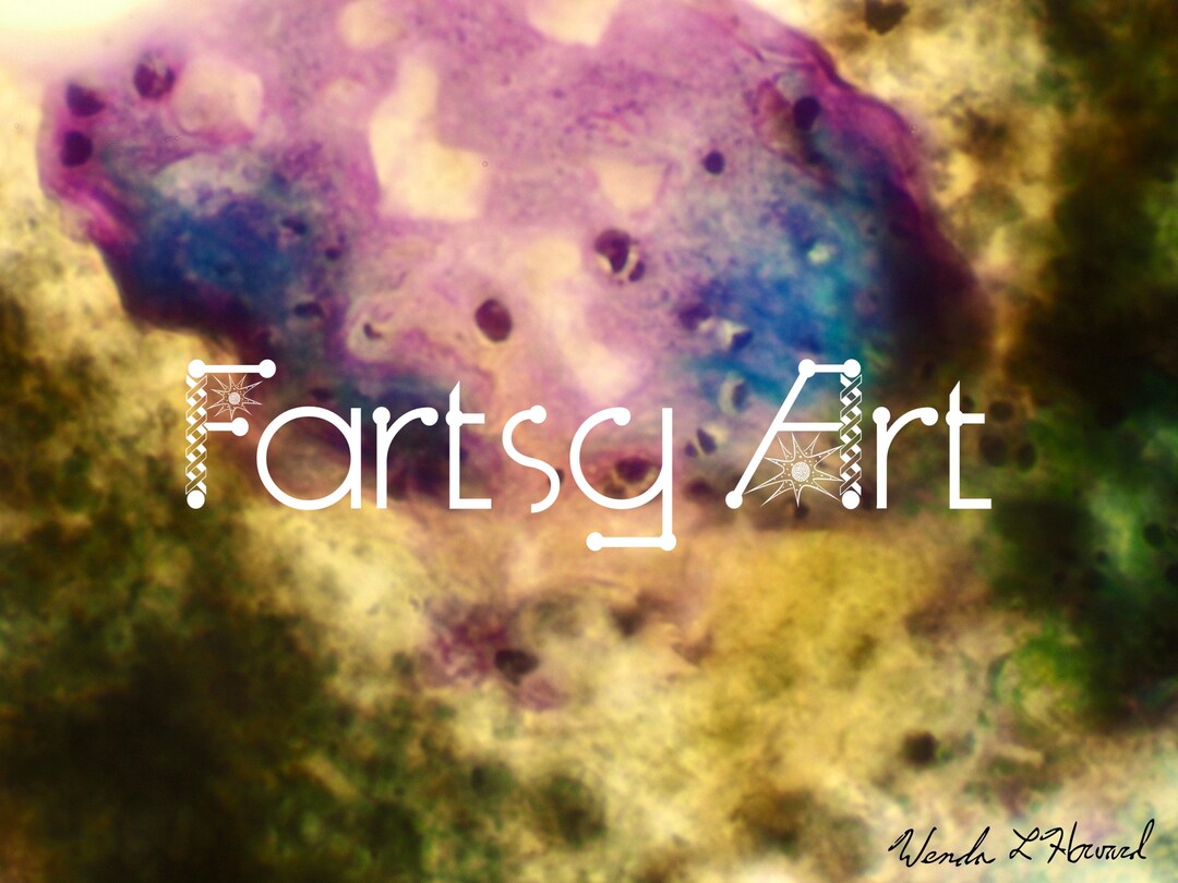 Colorful Chromatic Neisser Stain Abstract Original Photograph-canvas ...