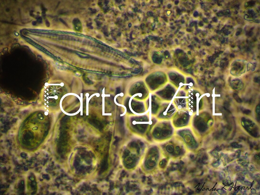 Green Algae & Diatom Microscopic Pond Life Original Photograph-canvas ...