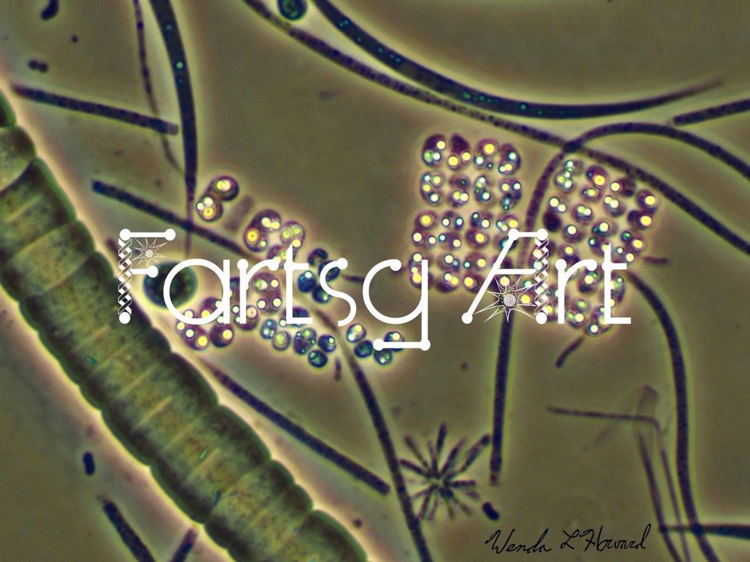 Microscopic Pond Water Algae & Bacteria Original Photograph-canvas Art ...