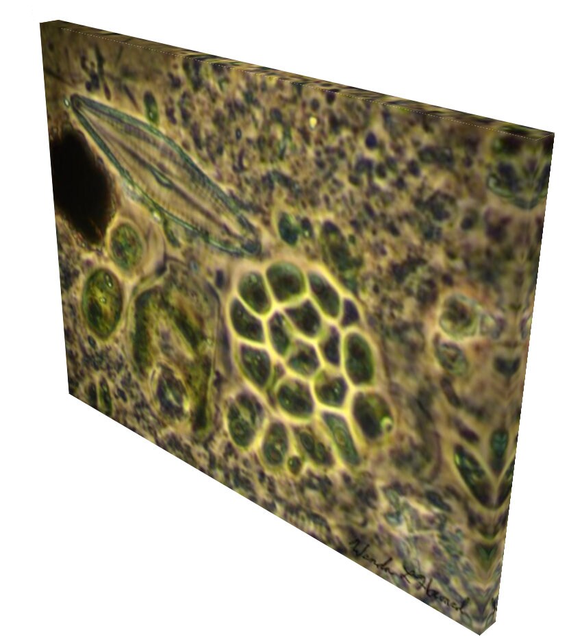 Green Algae & Diatom Microscopic Pond Life Original Photograph-canvas ...
