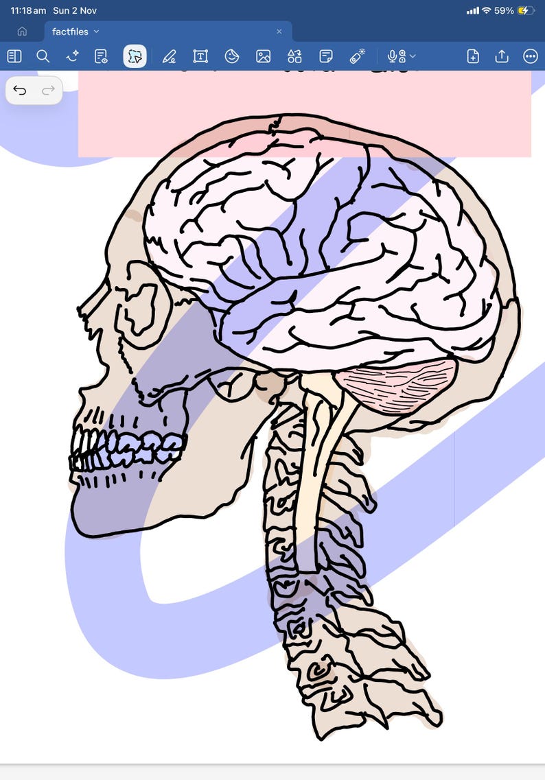 SNOOP Mnemonic Headache Questions - Etsy