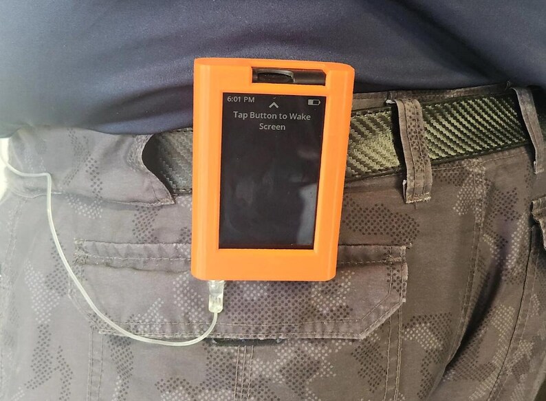 Ilet Black and White Screen | Insulin Pump | Insulin Case | Ilet ...