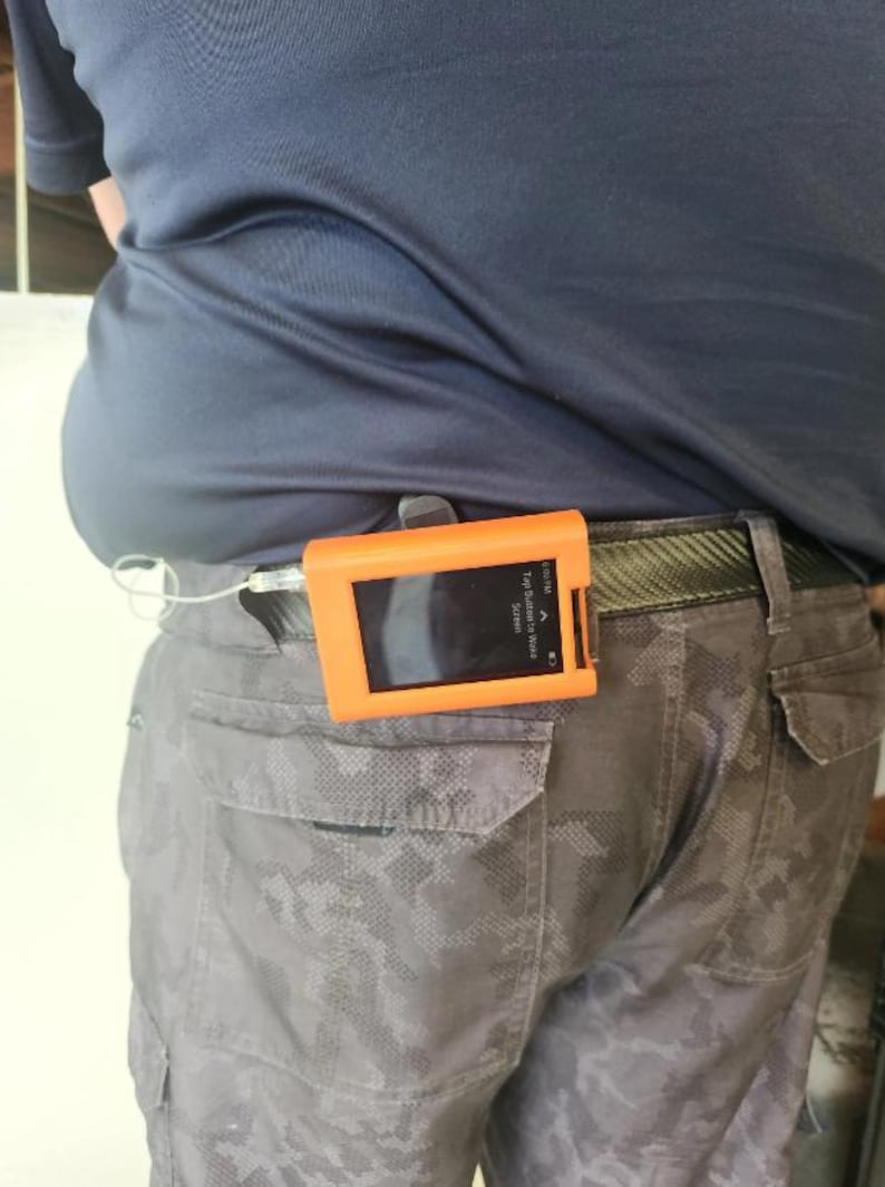 Ilet Black and White Screen | Insulin Pump | Insulin Case | Ilet ...