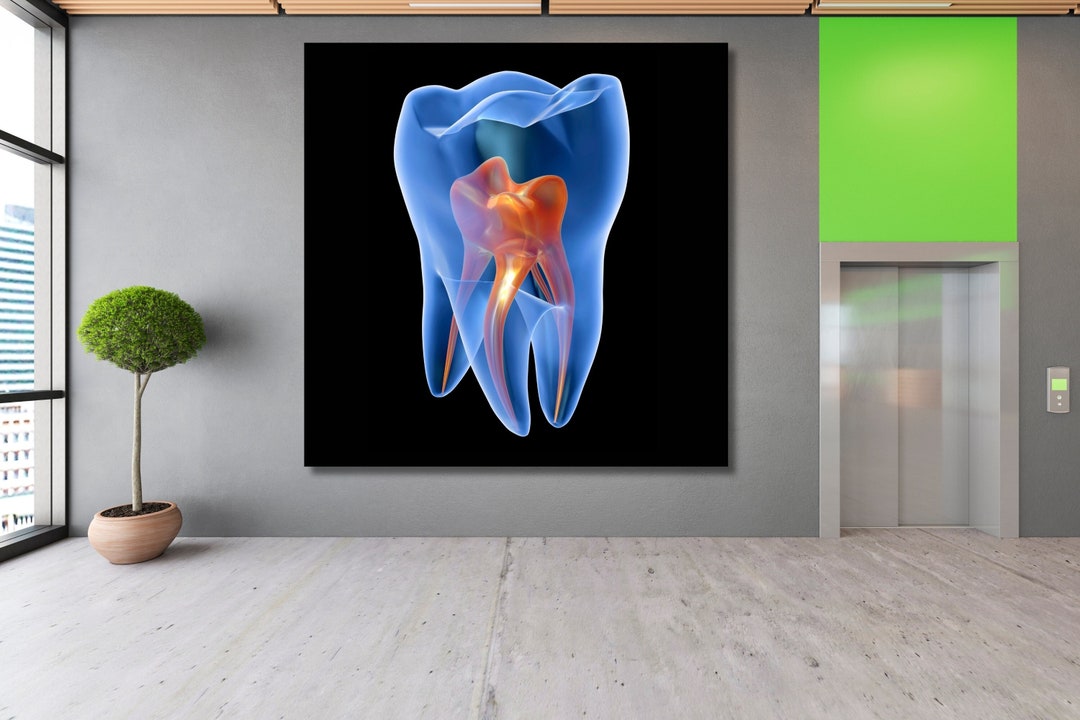 X-ray Molar Tooth Canvas Wall Art, Dentist Art, Dental Clinic Decor ...
