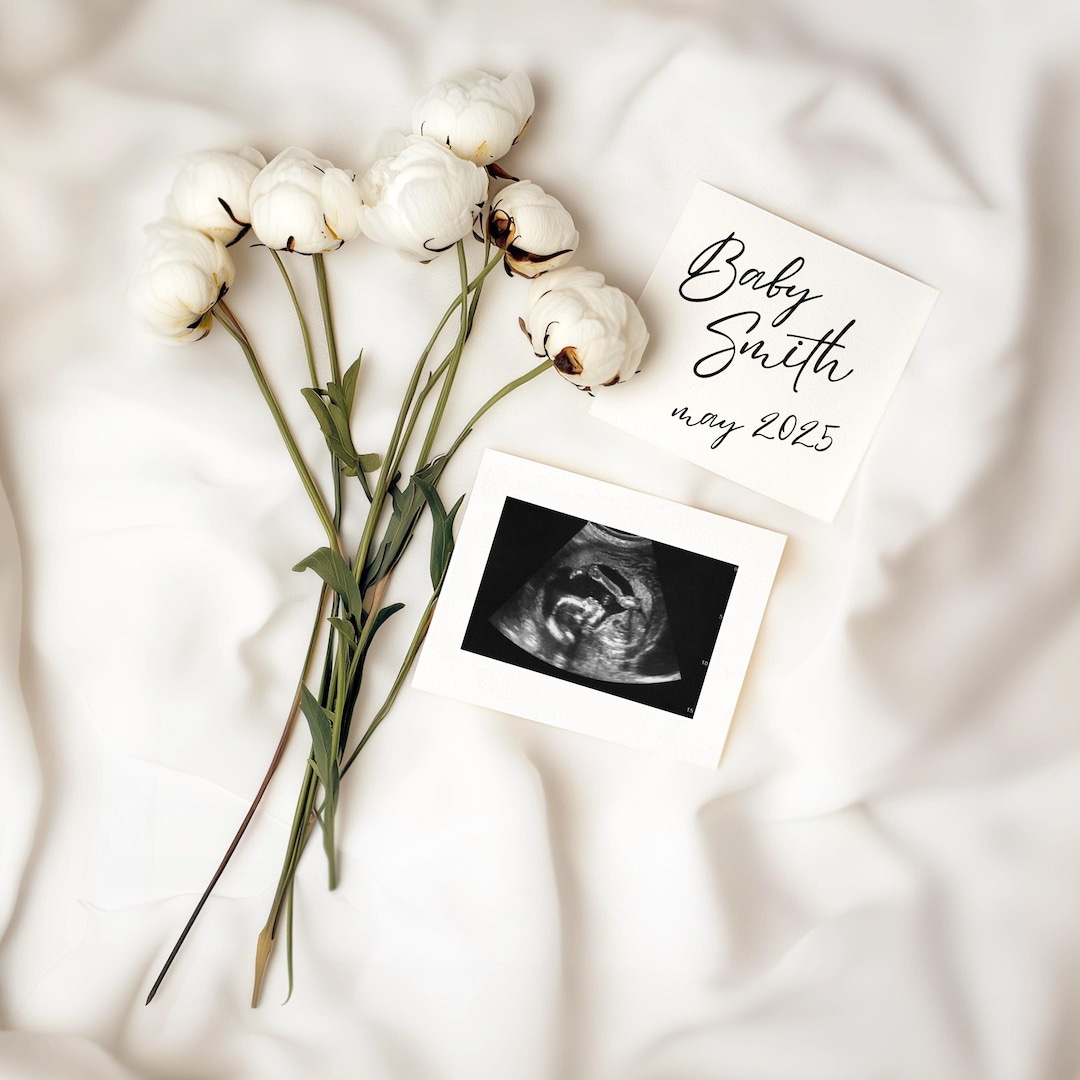 White Flowers Pregnancy Announcement Digital, Baby Reveal Custom Image ...
