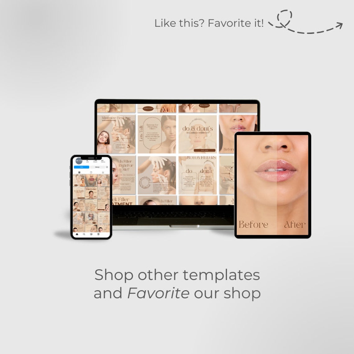 30 Botox and Filler Posts, Nurse Injector Instagram Templates, Lip ...