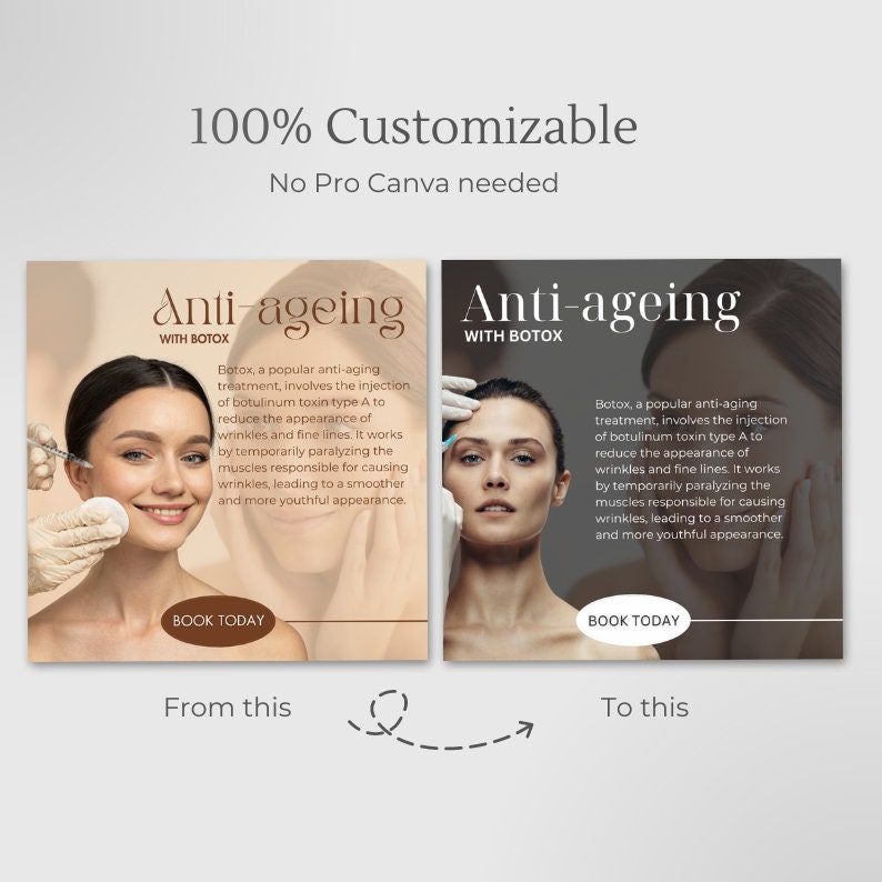 30 Botox and Filler Posts, Nurse Injector Instagram Templates, Lip ...