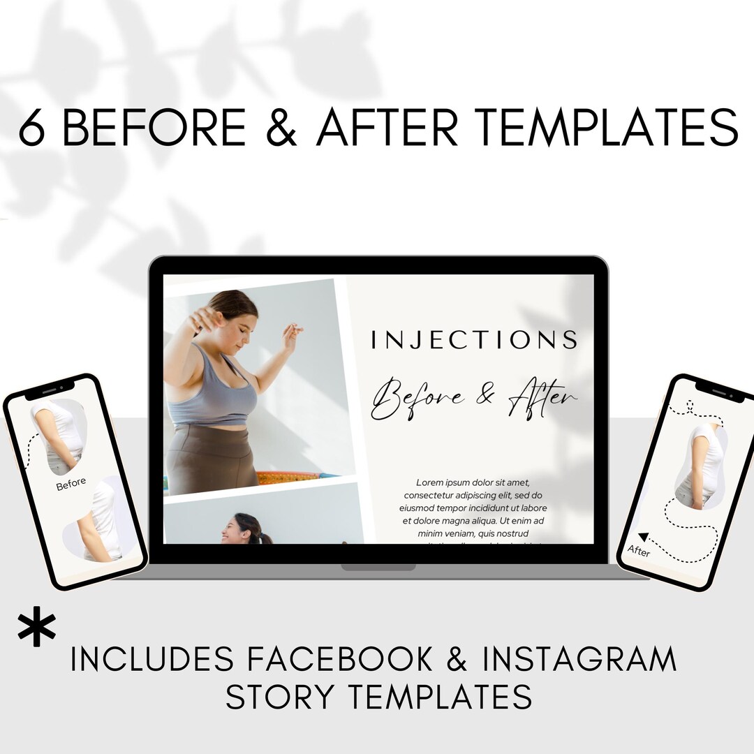 Semaglutide Tirzepatide Weight Loss Social Media Posts Tirzepatide ...