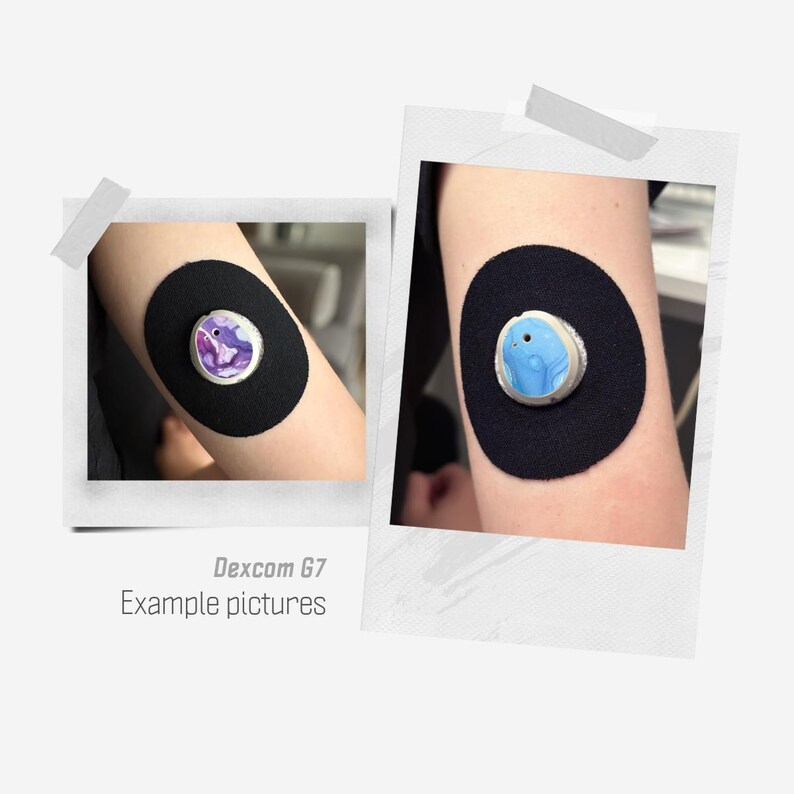 Dexcom G7 Stickers | Dexcom Decals | CGM Stickers | Dexcom Stickers ...