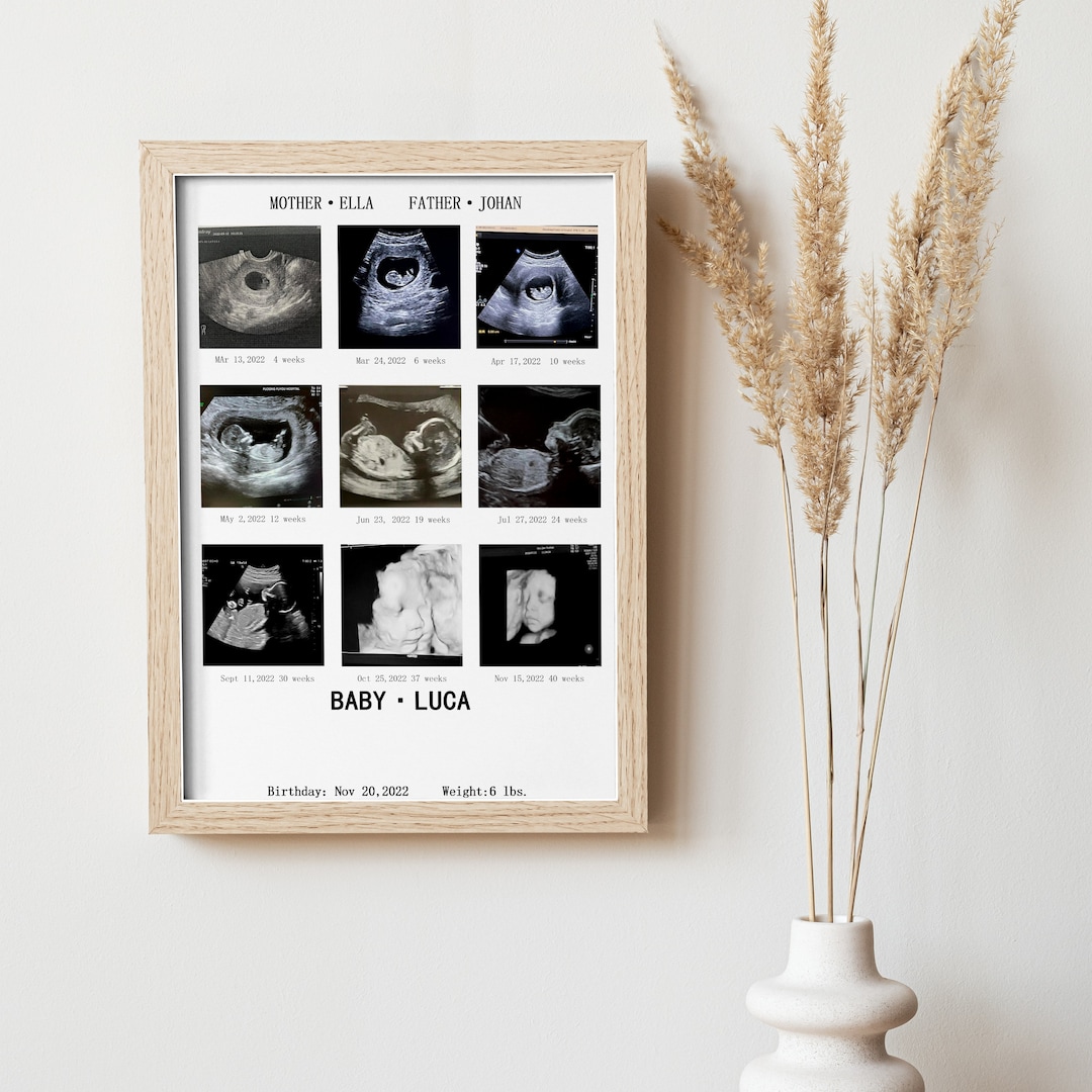 Personalized Baby Ultrasound Scanning Photo Frame Baby Ultrasound ...