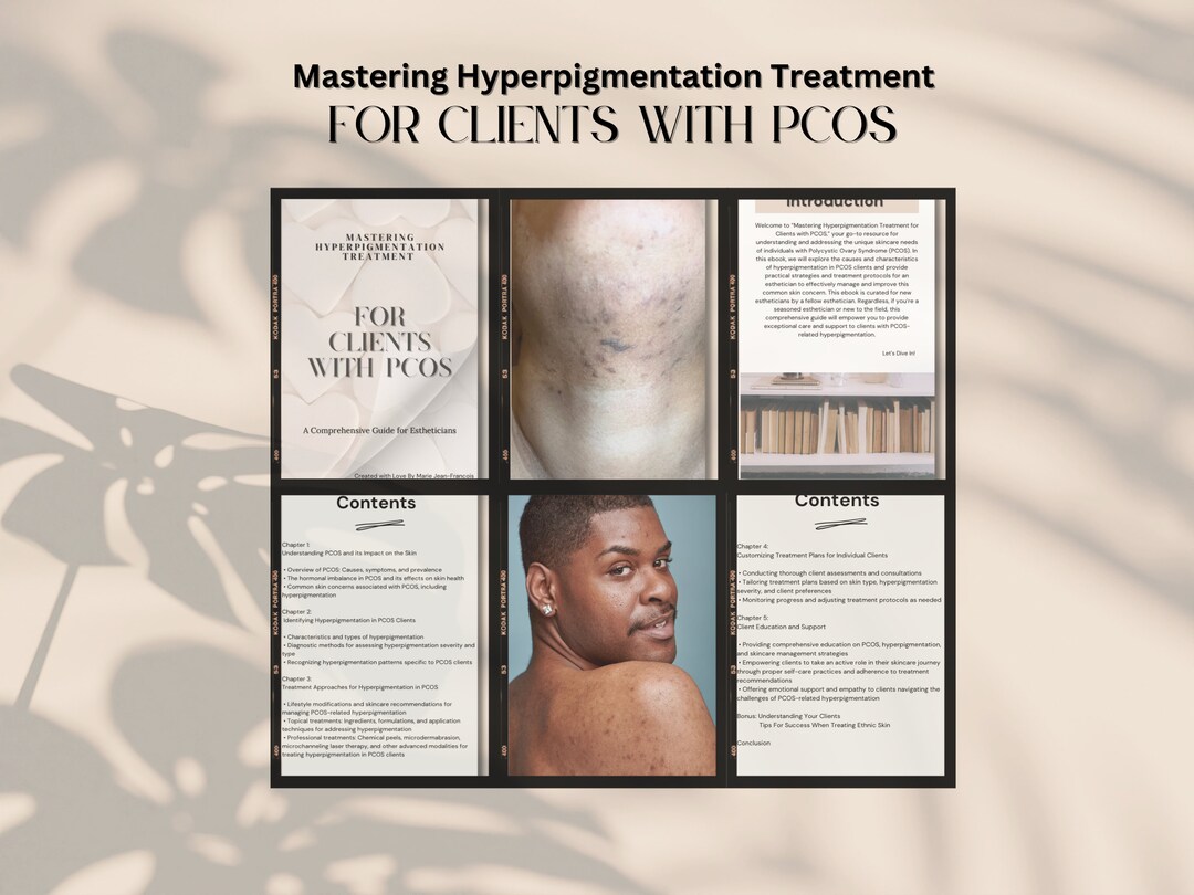 Mastering Hyperpigmentation Treatment for Clients With PCOS - Etsy