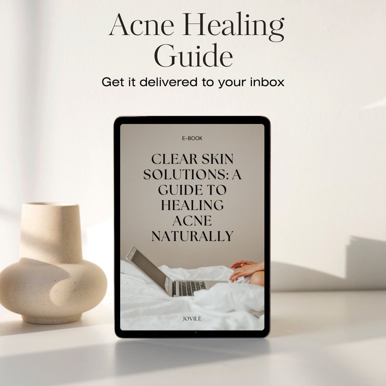 Acne Healing Guide - Etsy