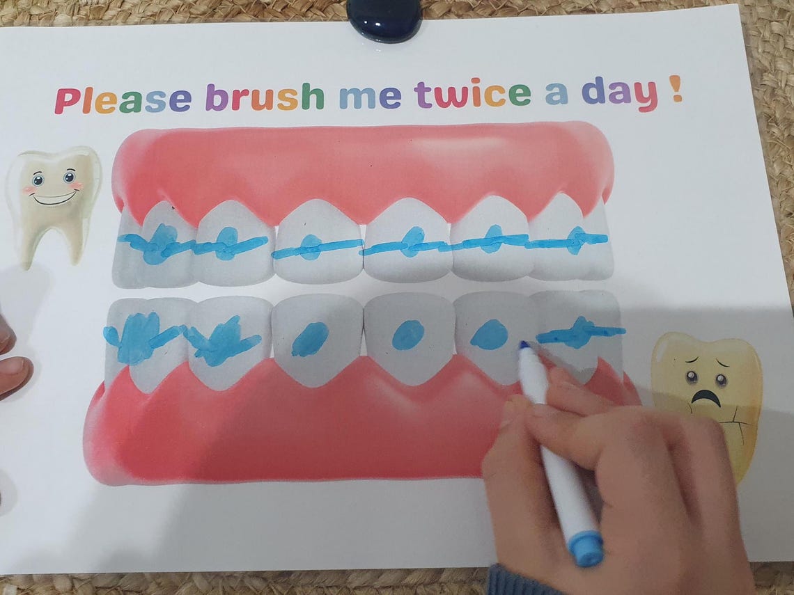 Teeth Brushing Chart for Toddler, Dental Care Activity, Busy Book Pages ...
