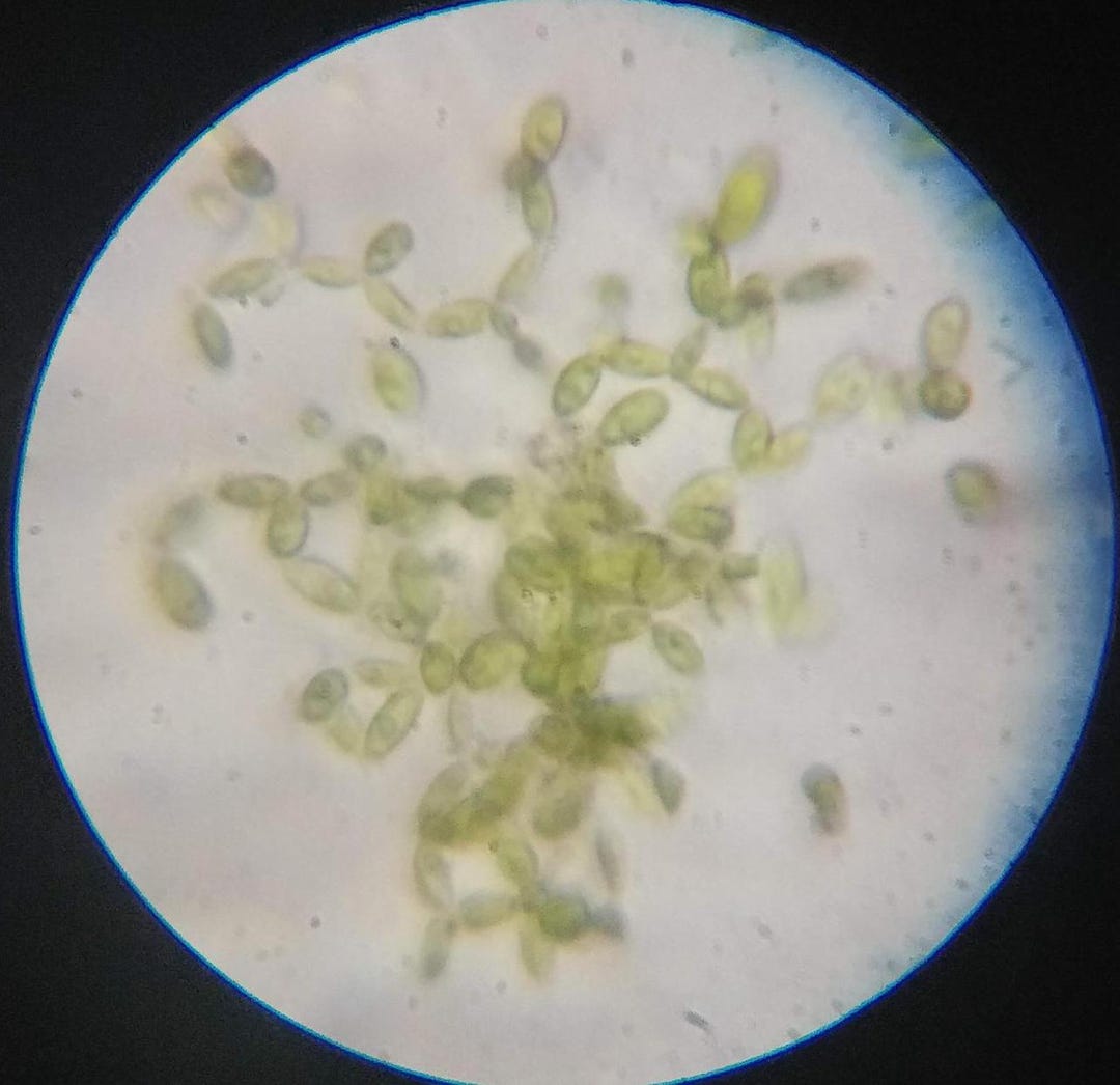 Fresh Acutodesmus Obliquus Algae Culture - Etsy