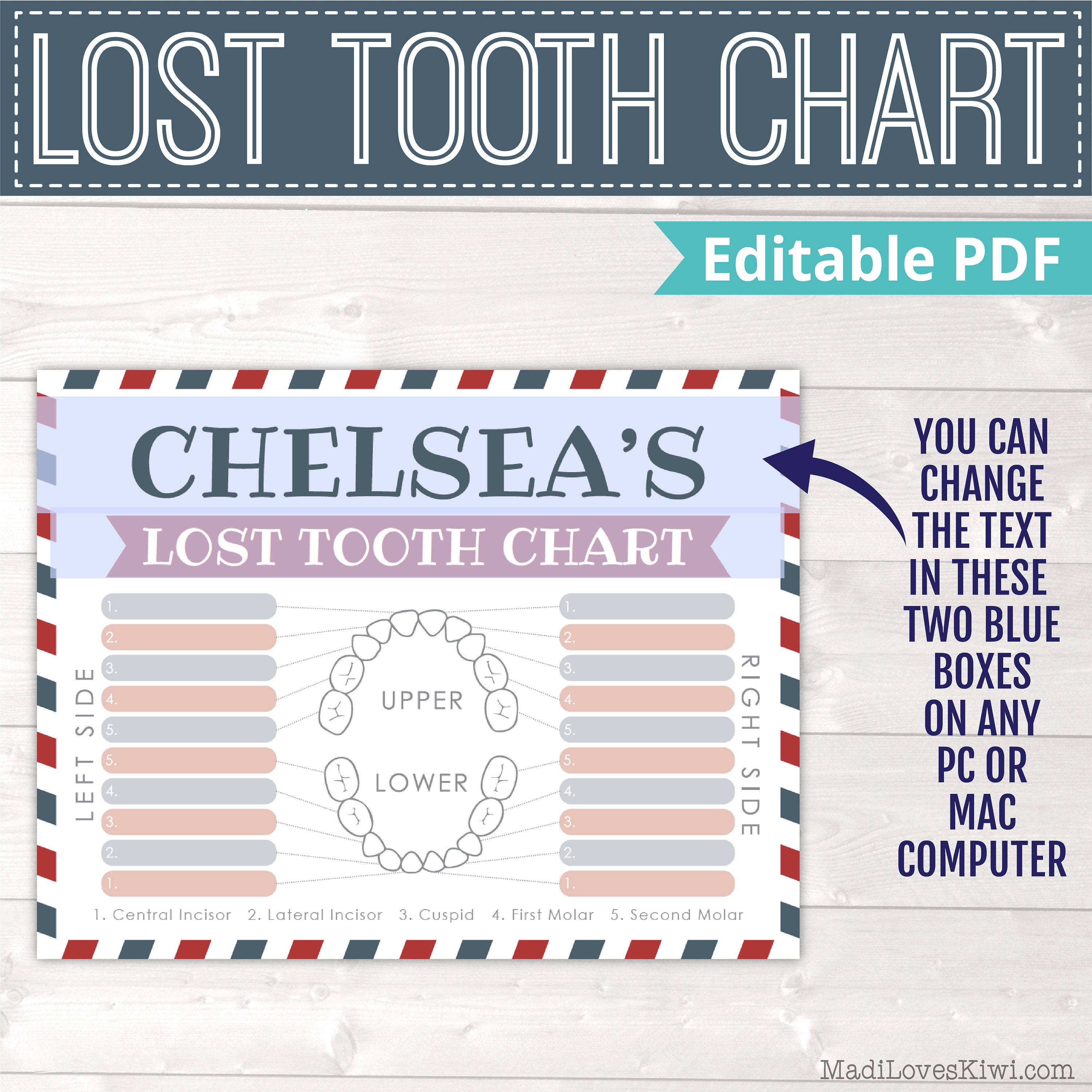Printable Lost Tooth Chart Missing Teeth Tracker Instant - Etsy UK