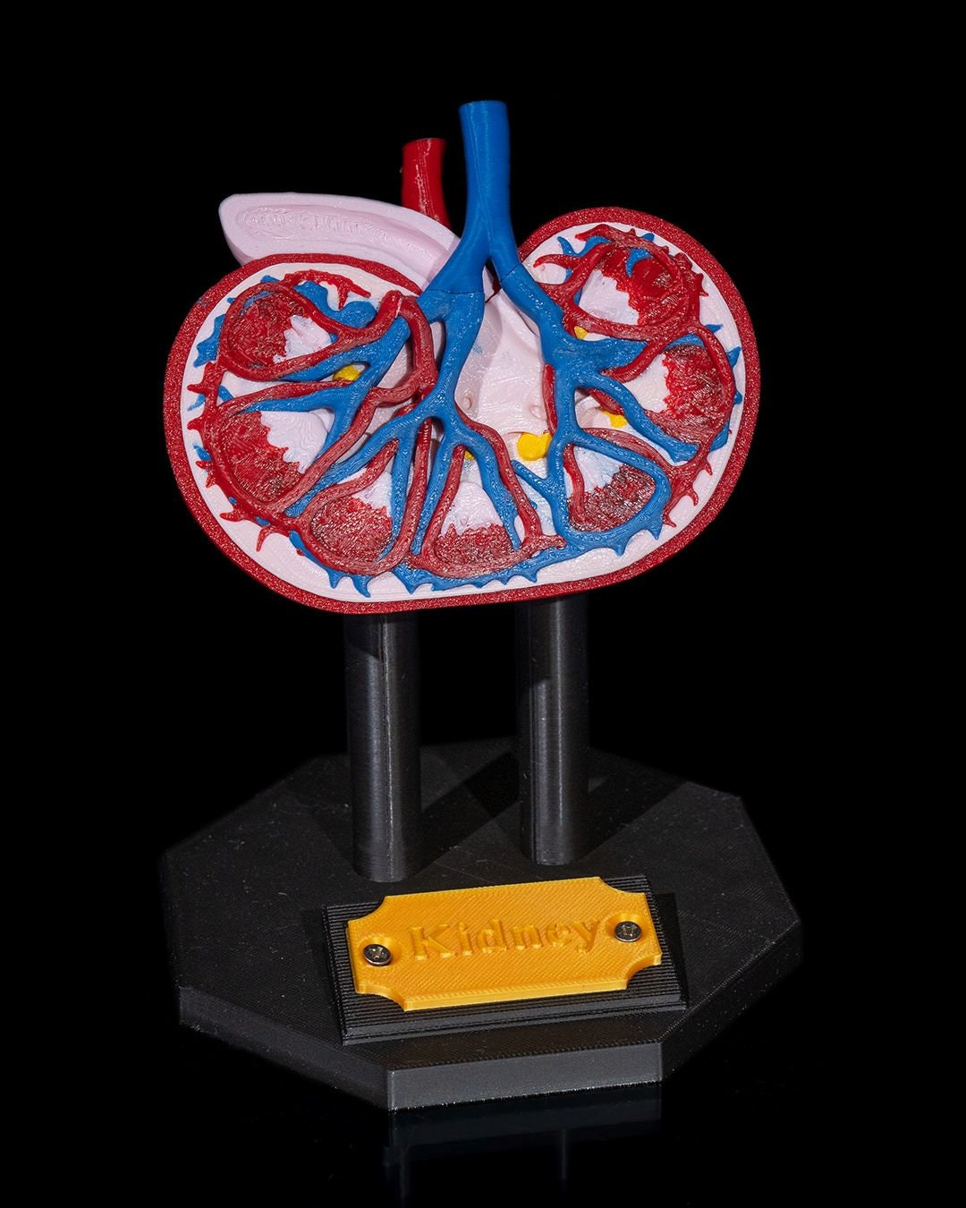 Kidney Anatomical Model | High-quality | 3D Printed - Etsy
