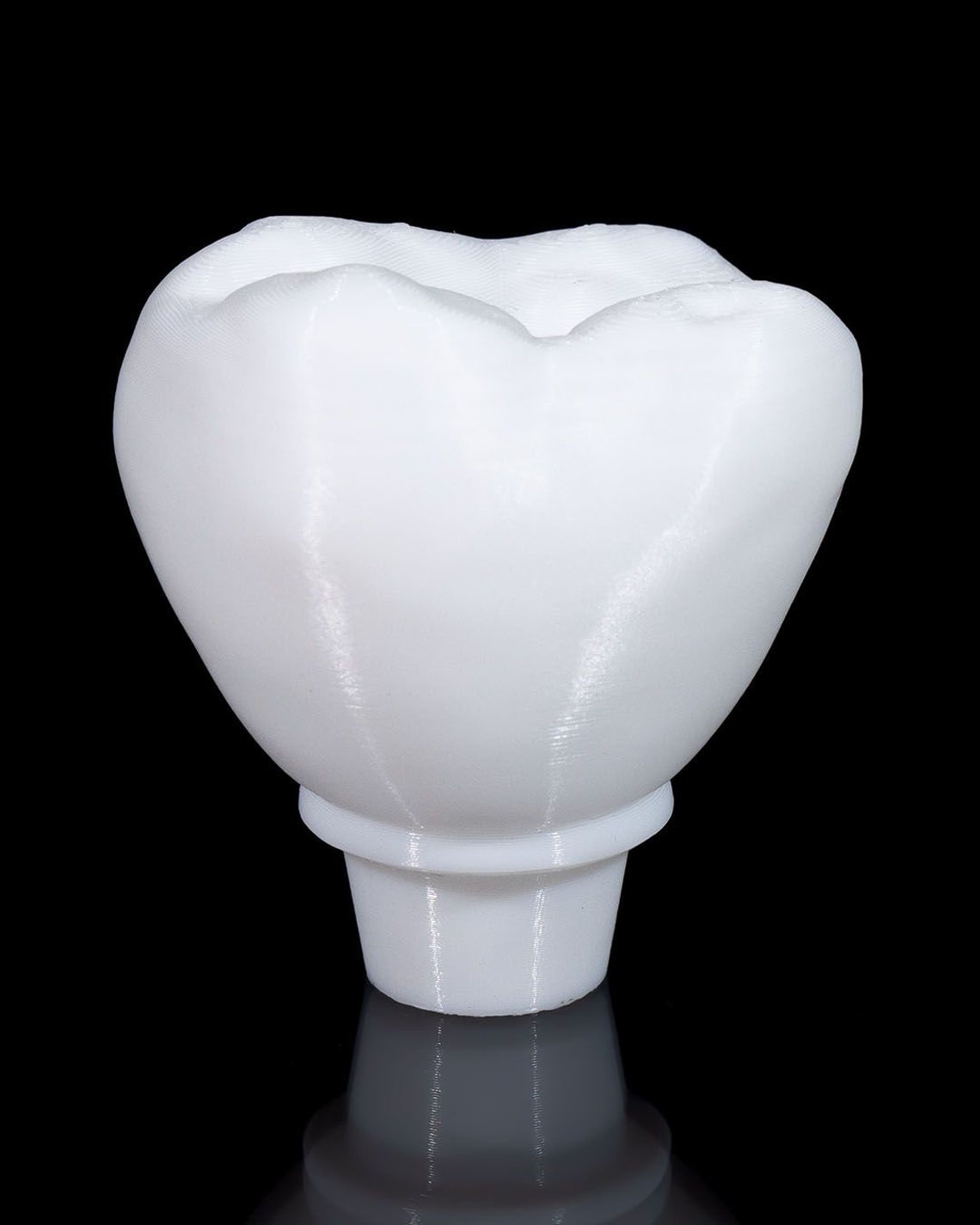 Realistic Dental Implant | 3D Printed Teeth Replica - Etsy