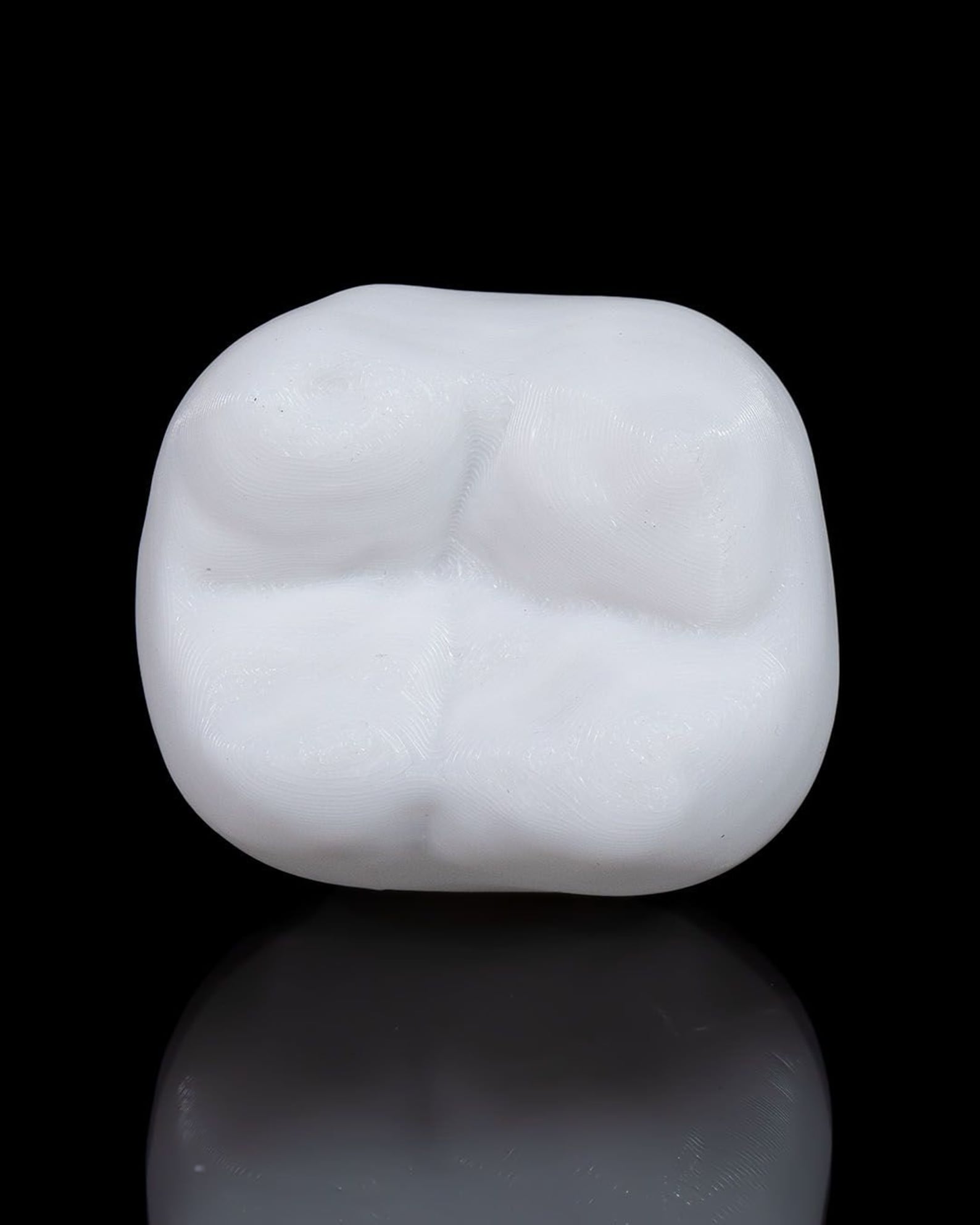 Realistic Dental Implant | 3D Printed Teeth Replica - Etsy