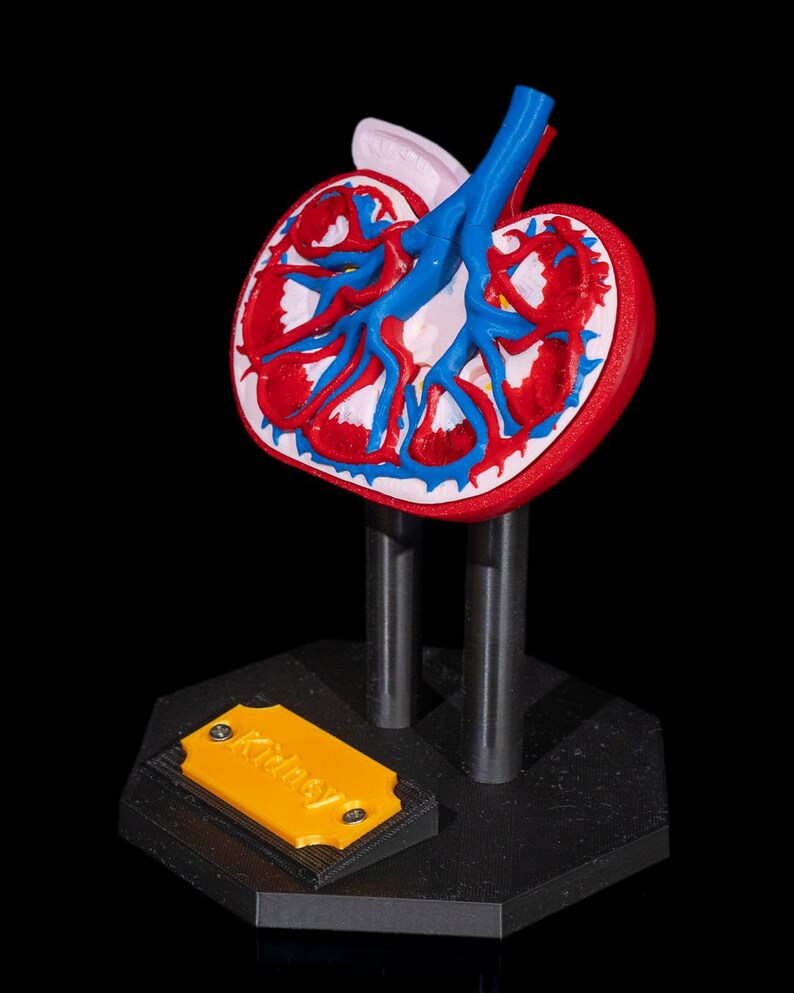 Kidney Anatomical Model | High-quality | 3D Printed - Etsy