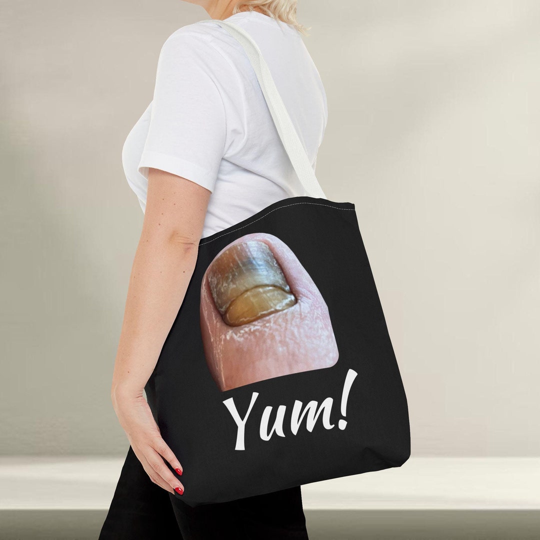 Toenail Fungus Tote Bag, World's Worst Gross Out, Toete Bag, Yuck, Yum ...