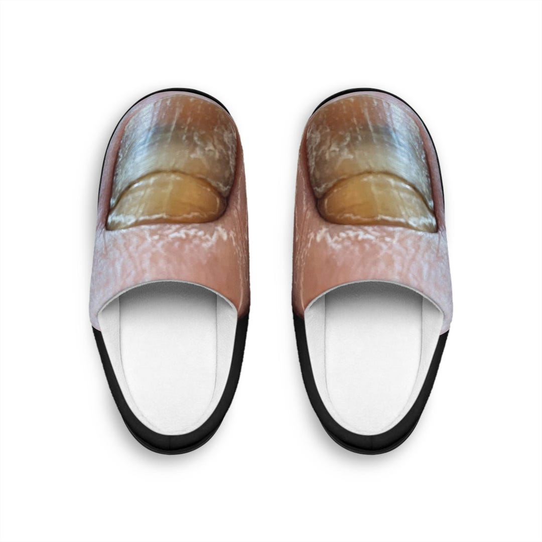 Horrible Toe Fungus Men's Indoor Slippers, World's Worst Gross Joke Gag ...