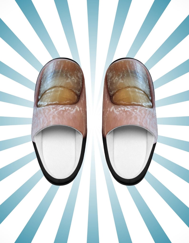 Gross Toe Fungus Slippers, Funny World's Worst Joke Gag, Horrible ...
