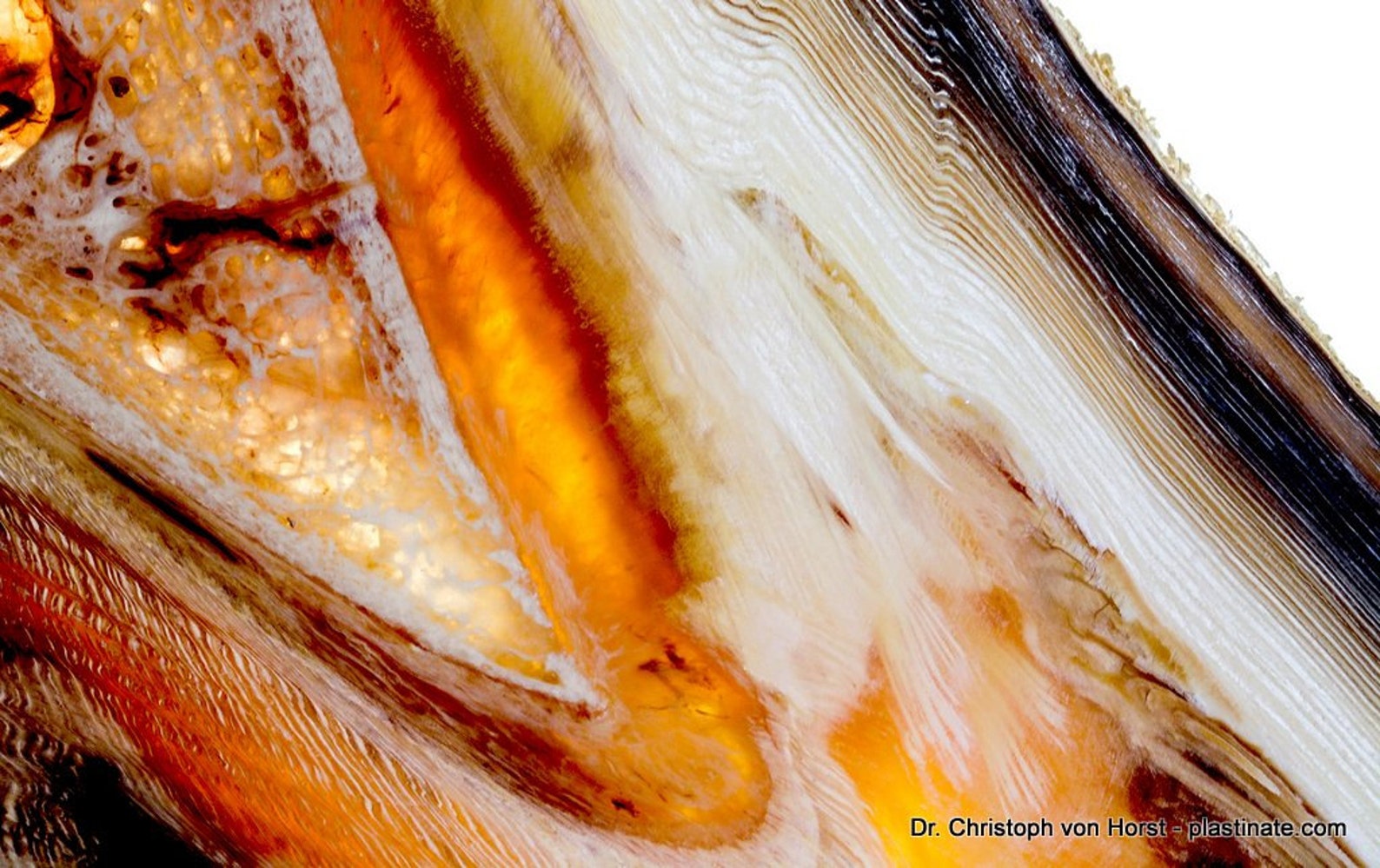 Equine Coffin Bone Rotation Foundered Hoof Horse Laminitis Pathology ...