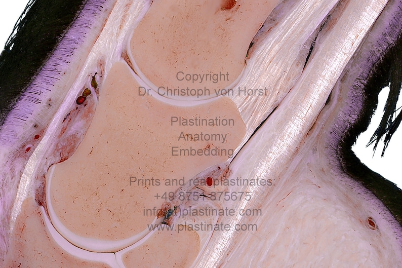 Equine Laminitis Foundered Horse Hoof Pathology Coffin Bone Horn ...