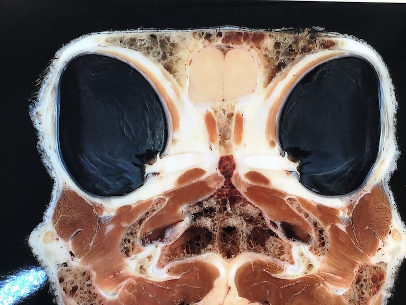 Ostrich Head Brain Eye Bird Avian Optic Nerv Anatomy Specimen Print - Etsy