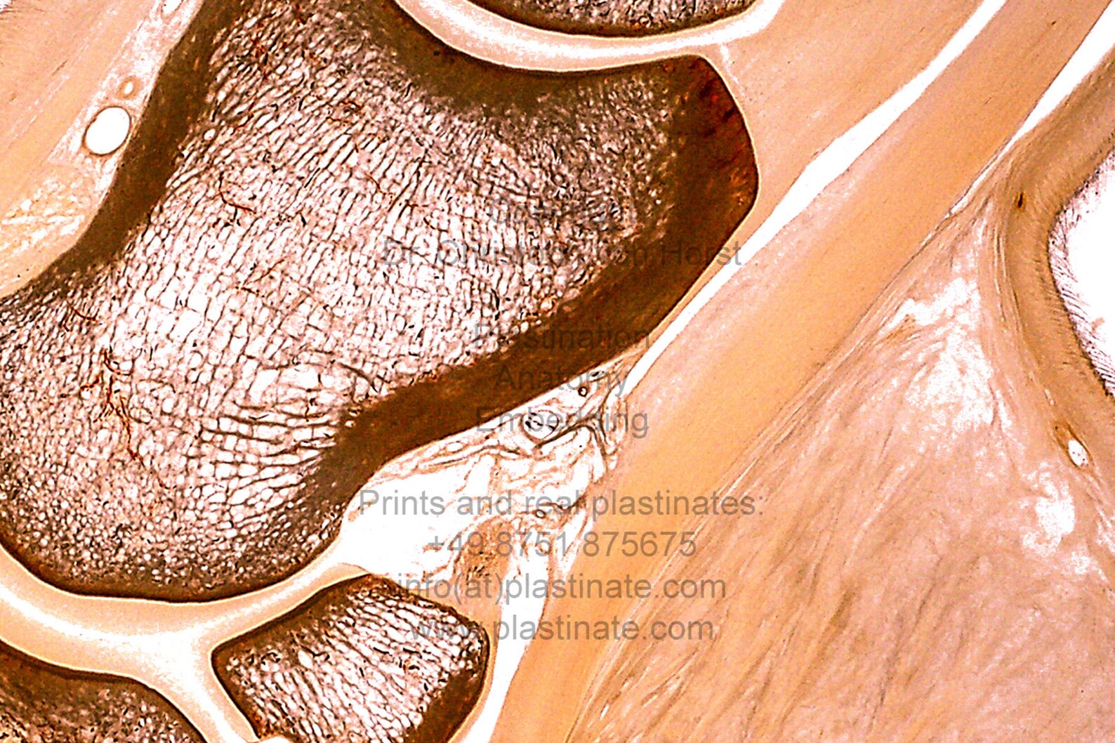 Laminitis hollow loose hoof wall separation equine laminitic | Etsy