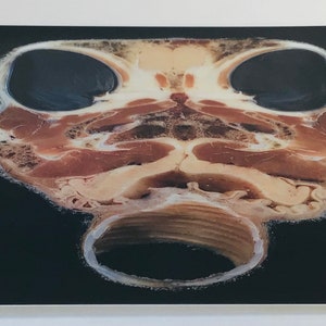 Ostrich Head Brain Eye Bird Avian Optic Nerv Anatomy Specimen Print ...