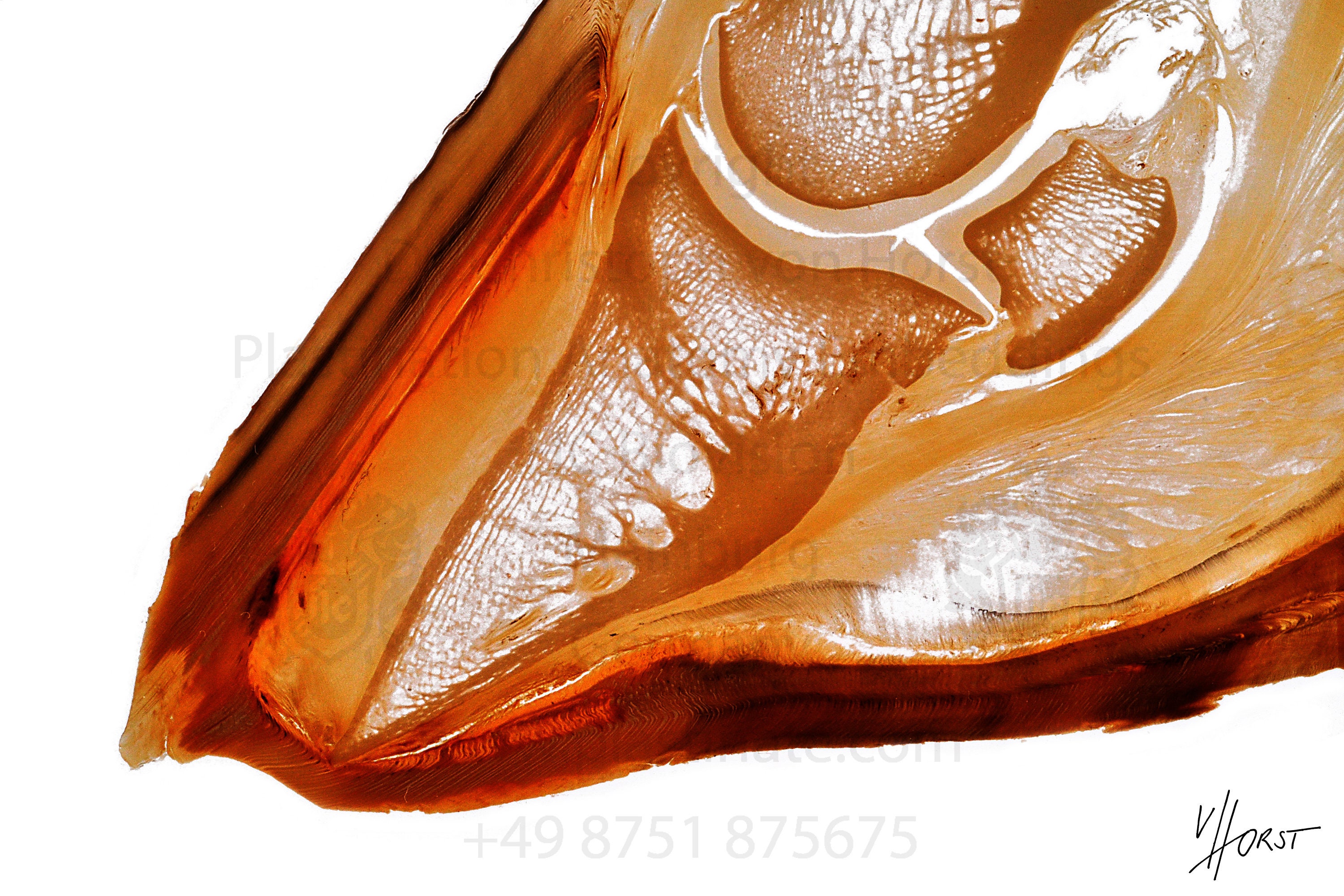 Equine Hoof Coffin Bone Incomplete Hoof Sole Perforation Laminitis ...