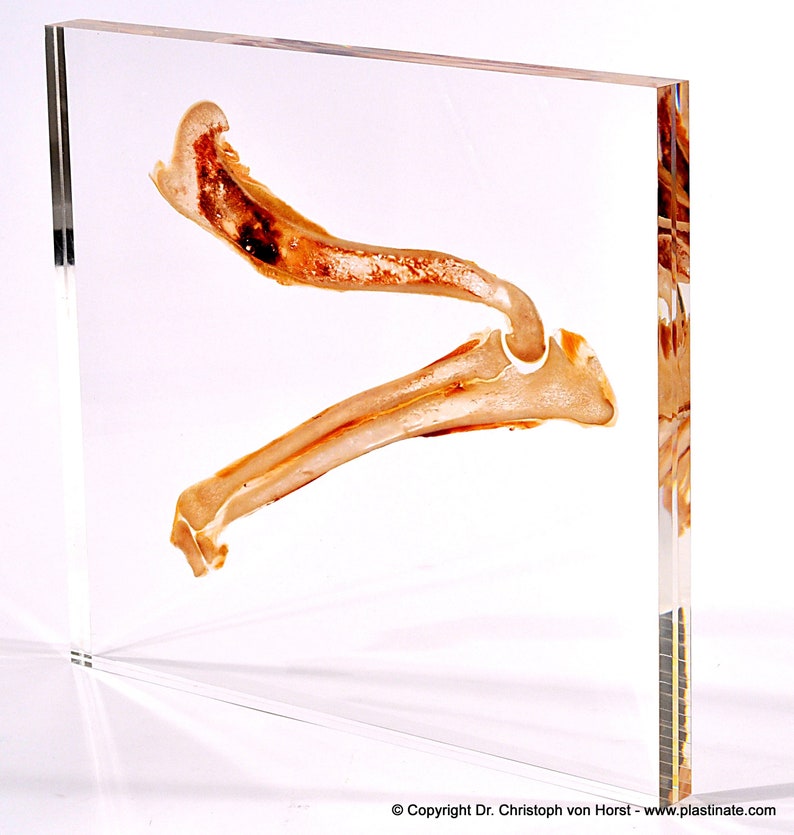 Real Anatomical TTT - Sheet Plastinate - Plastinated Anatomy Specimen ...