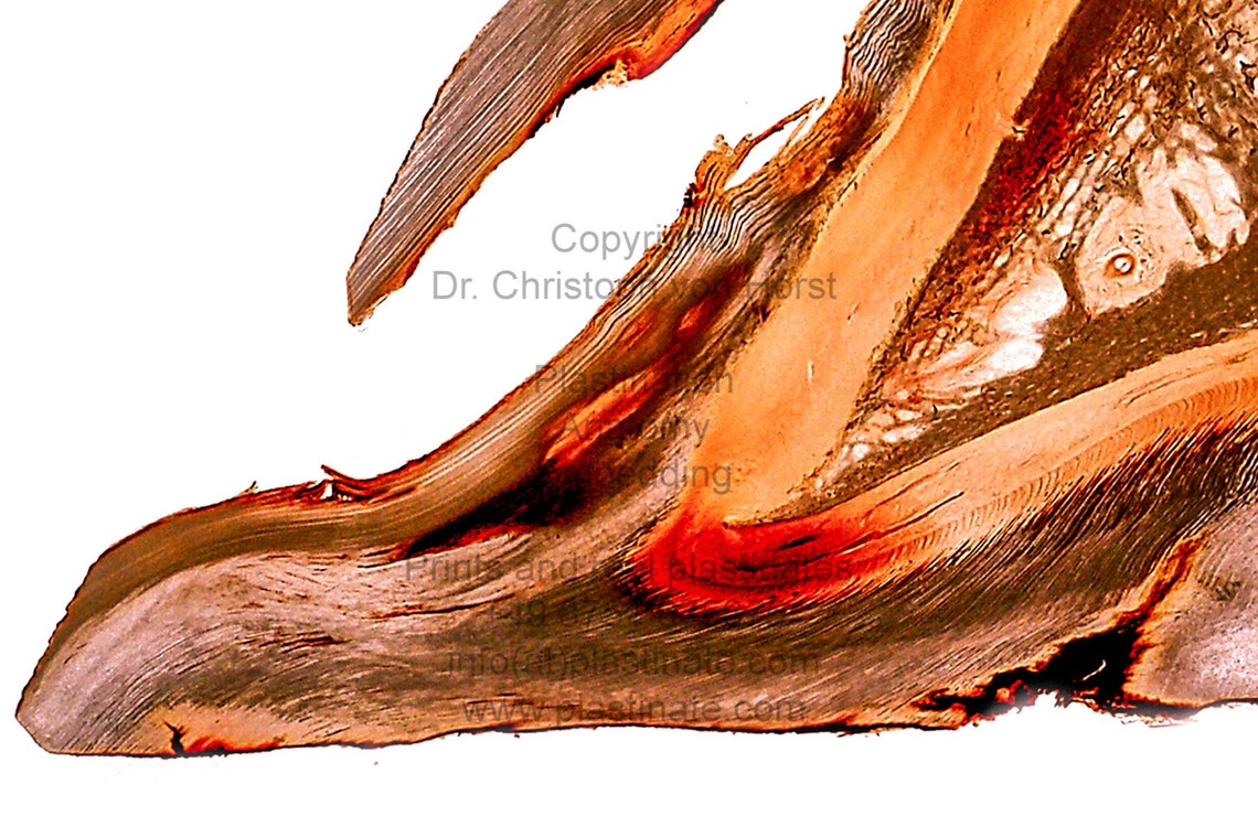 Laminitis hollow loose hoof wall separation equine laminitic | Etsy