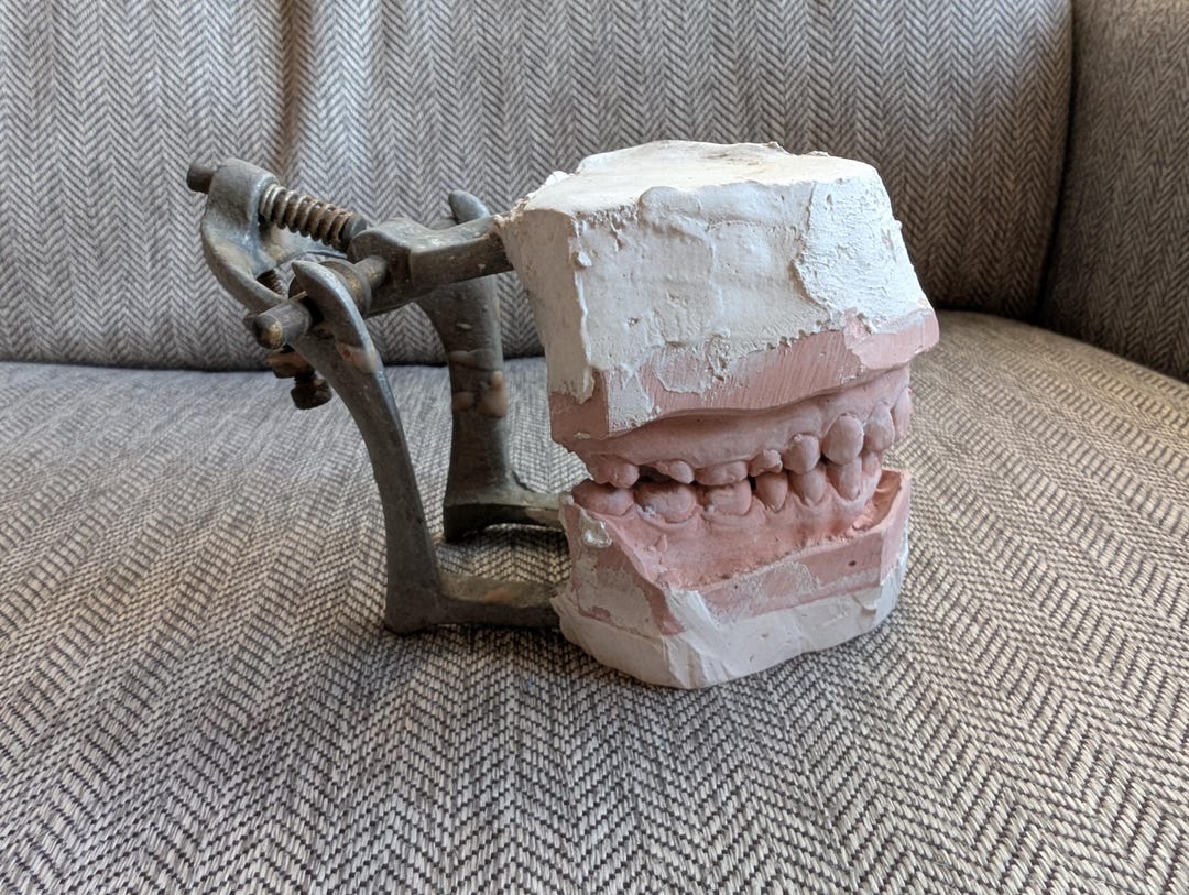 Vintage Dental Teeth Cast Medical Oddity. Dentist Tooth Impression Mold ...
