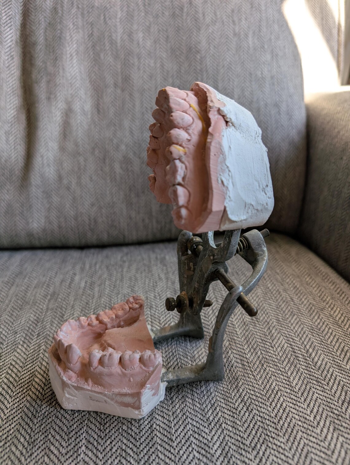 Vintage Dental Teeth Cast Medical Oddity. Dentist Tooth Impression Mold ...