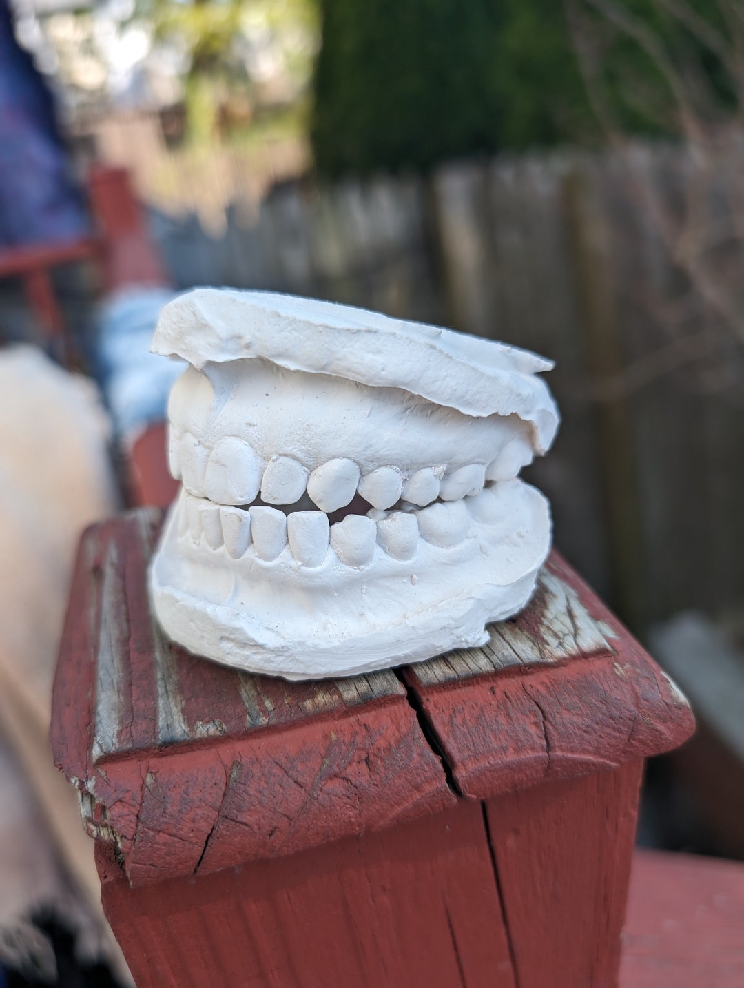 Vintage Dental Teeth Cast Medical Oddity. Dentist Tooth Impression Mold ...