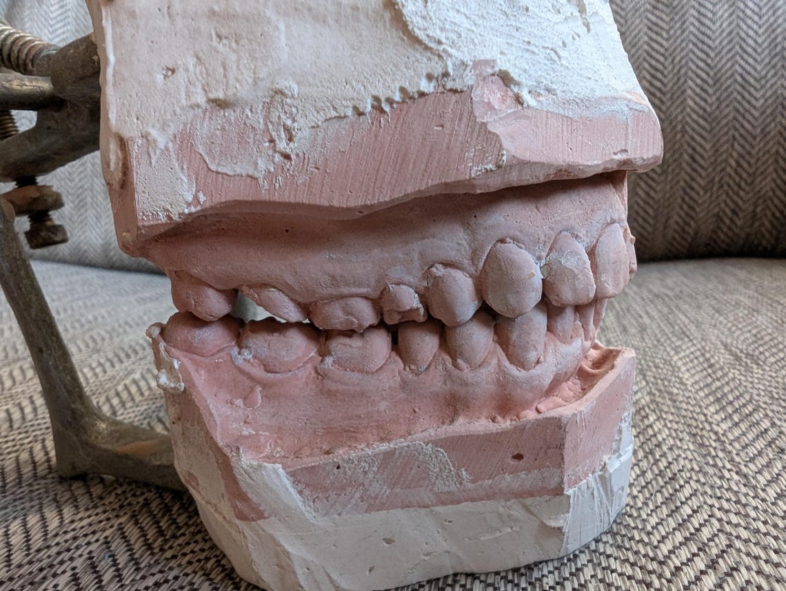 Vintage Dental Teeth Cast Medical Oddity. Dentist Tooth Impression Mold ...