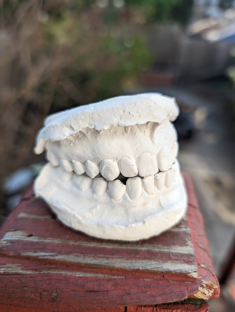 Vintage Dental Teeth Cast Medical Oddity. Dentist Tooth Impression Mold ...