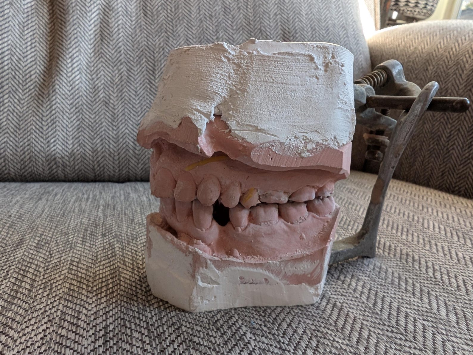 Vintage Dental Teeth Cast Medical Oddity. Dentist Tooth Impression Mold ...
