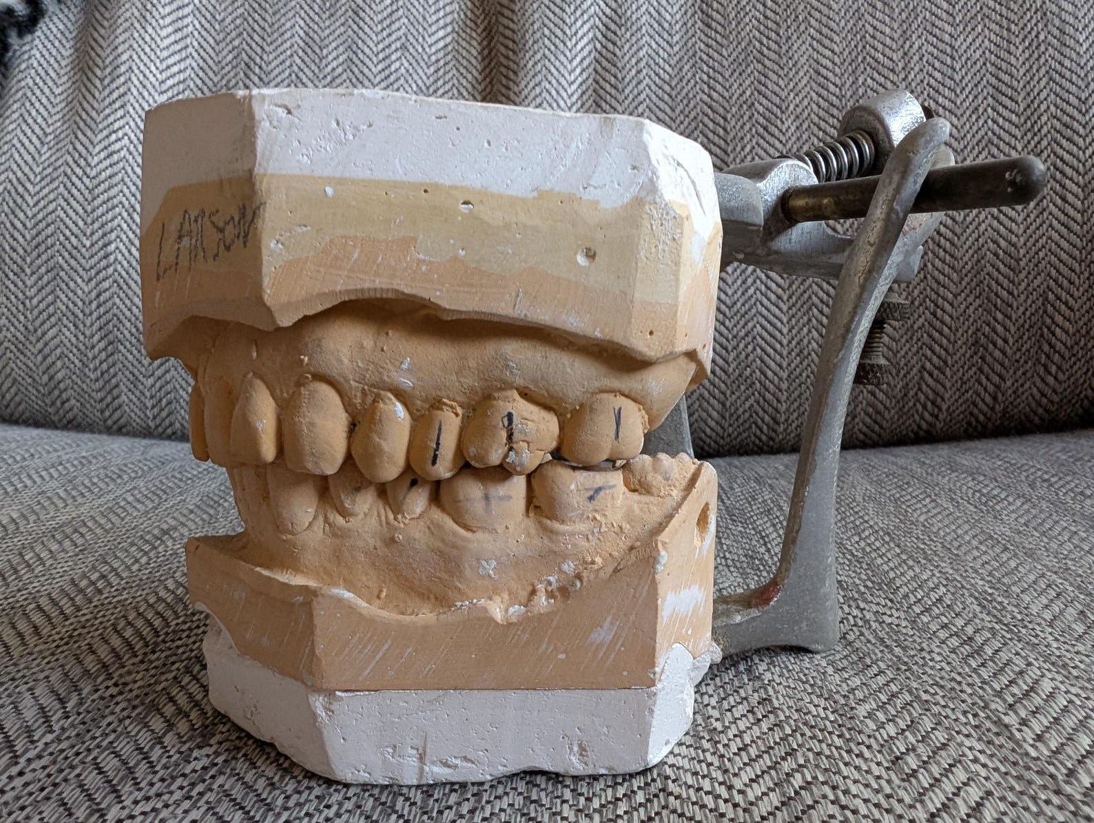 Vintage Dental Teeth Cast Medical Oddity. Dentist Tooth Impression Mold ...