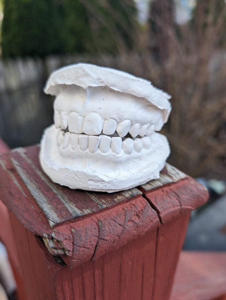 Vintage Dental Teeth Cast Medical Oddity. Dentist Tooth Impression Mold ...