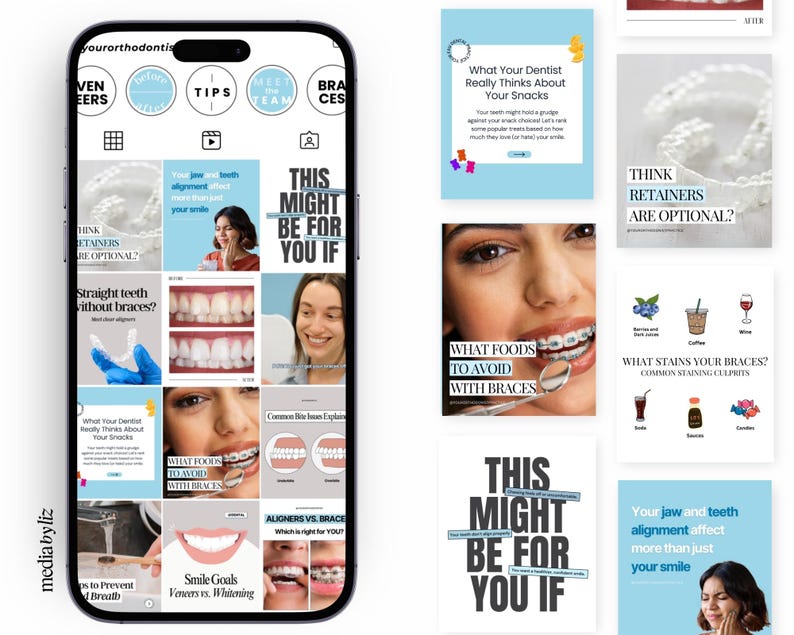 Orthodontist Instagram Templates | Braces & Invisalign Social Media Kit ...