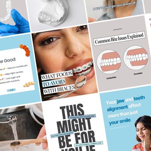 Orthodontist Instagram Templates | Braces & Invisalign Social Media Kit ...