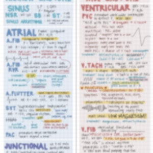 EKG Cheat Sheet - Digital Download - Etsy