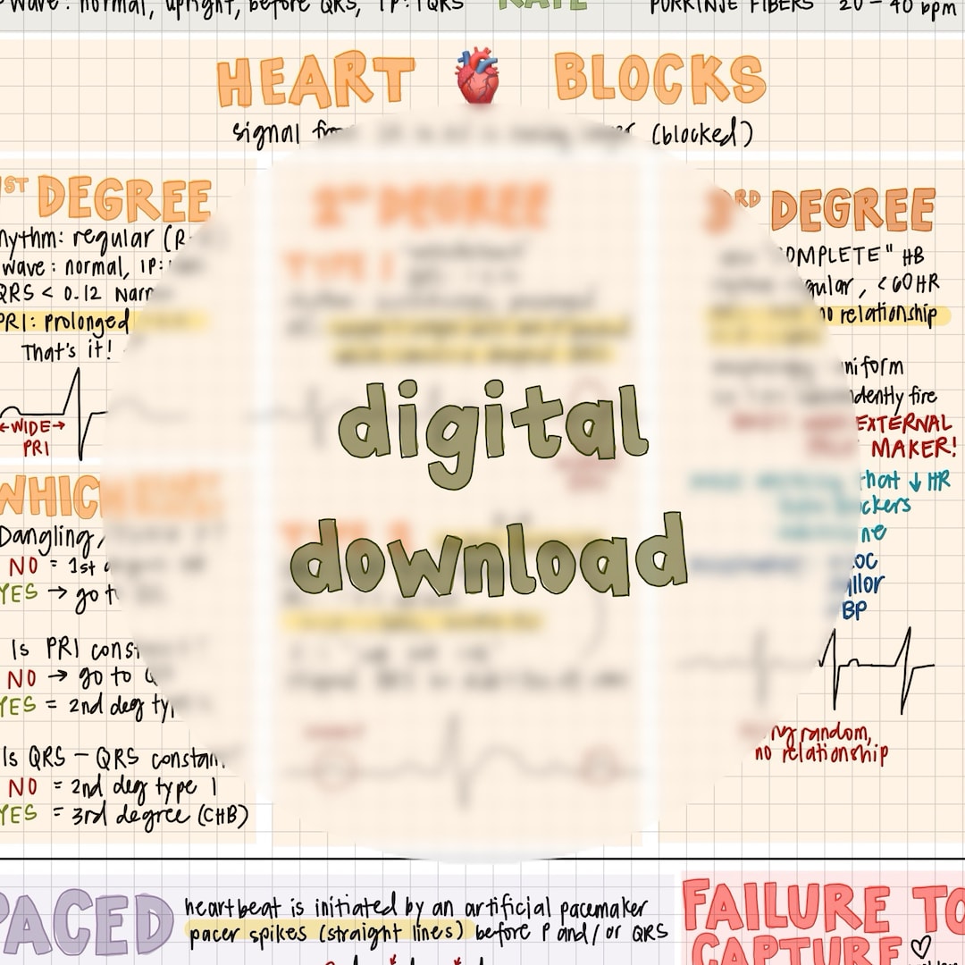 EKG Heart Block Cheat Sheet - Digital Download - Etsy