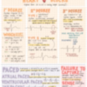 EKG Heart Block Cheat Sheet - Digital Download - Etsy