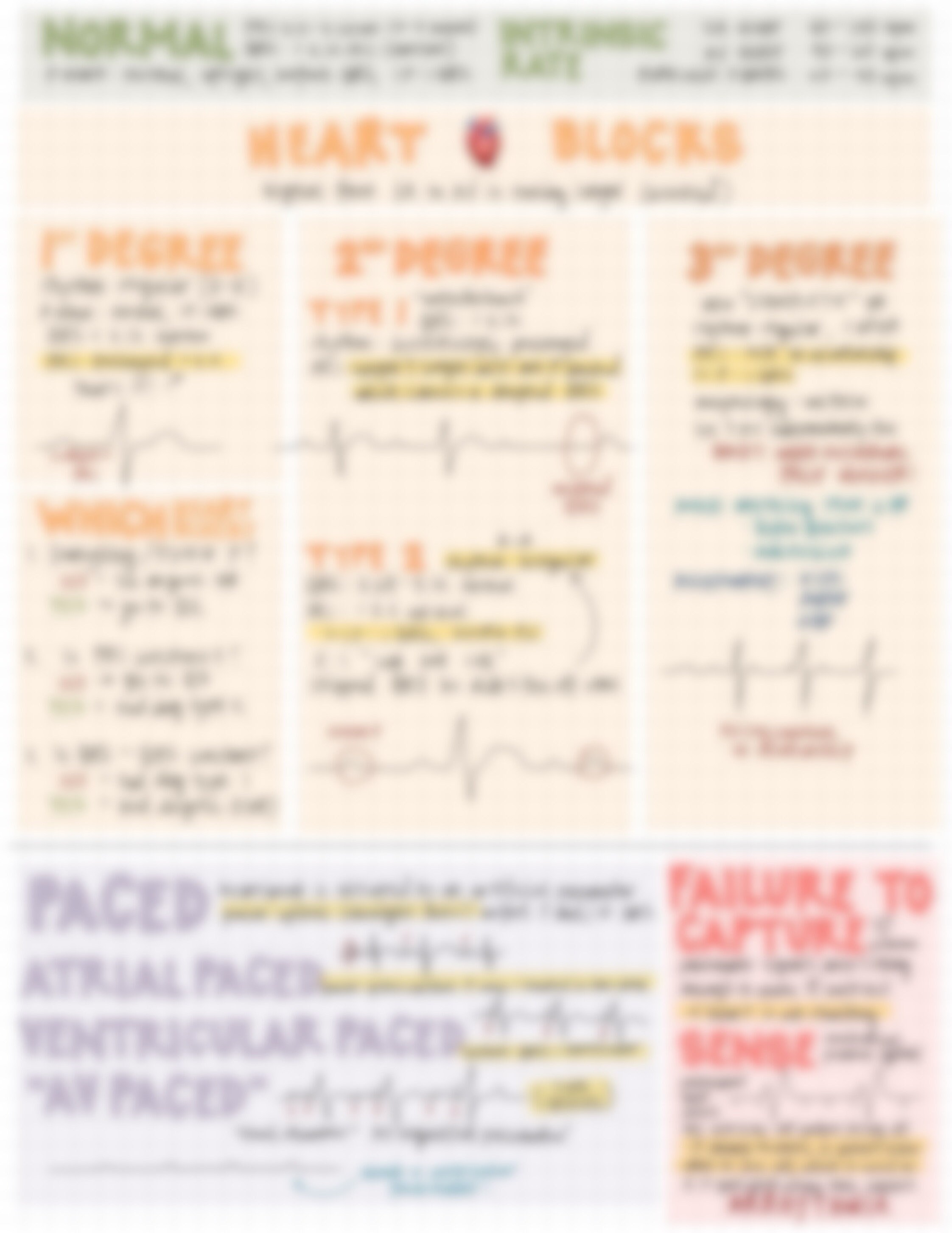EKG Heart Block Cheat Sheet - Digital Download - Etsy
